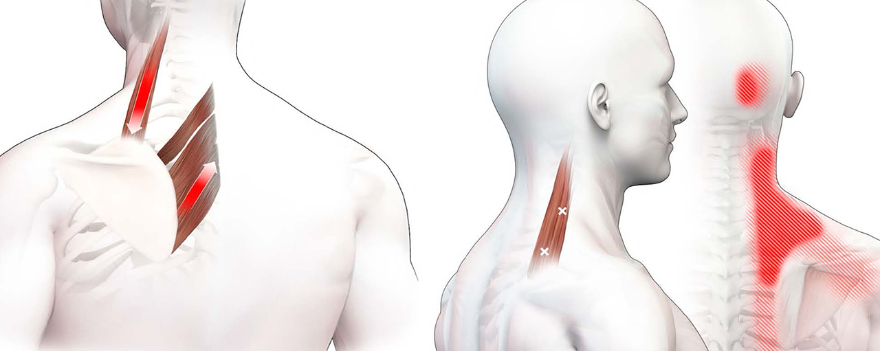 Kennisbank - Triggerpoint Coach